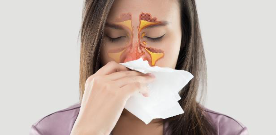 O que causa a sinusite? Entenda como tratar essa doença - Unidade de ...